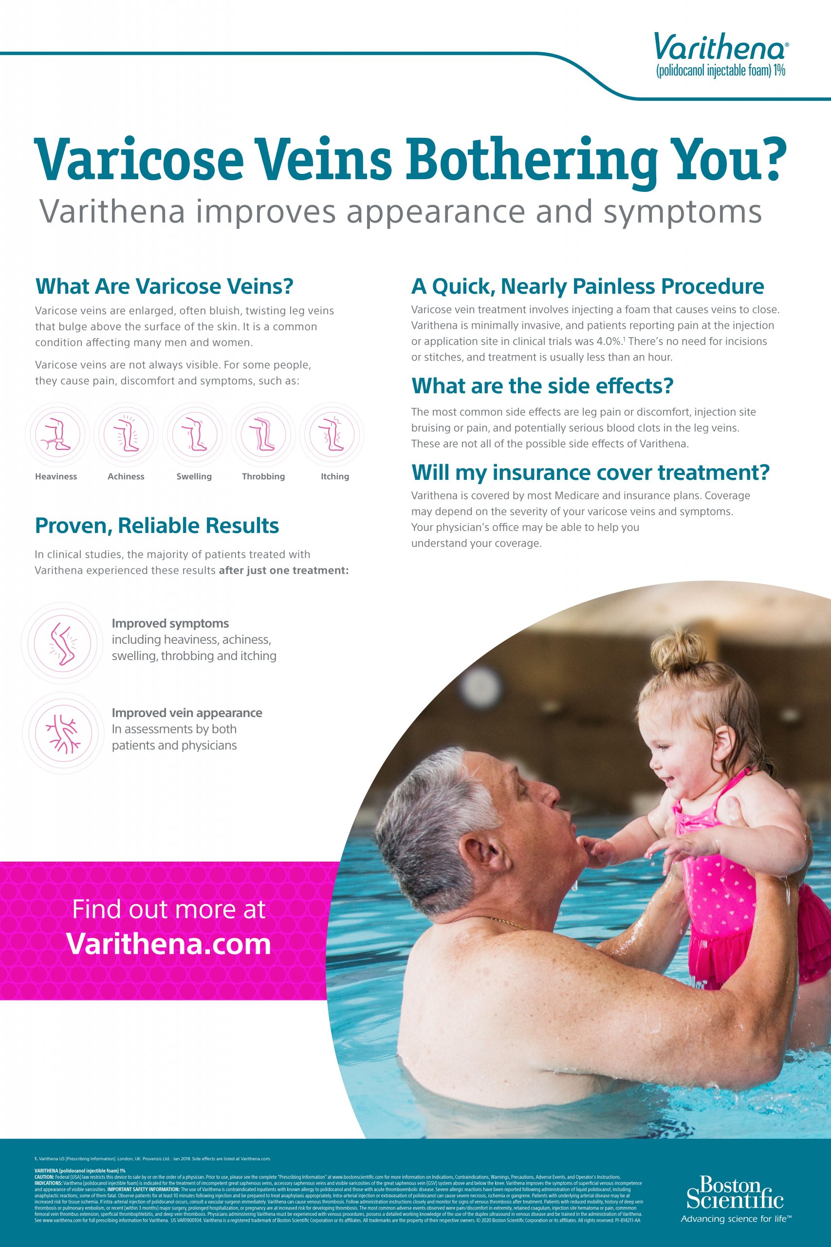 Treating Varicose Veins with Varithena® - Indiana Vein & Lymphatic